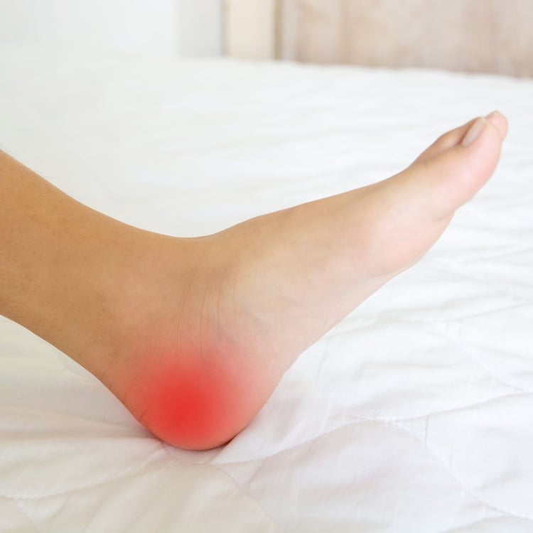 When Heel Pain Won’t Go Away: Is It Time to See a Podiatrist?